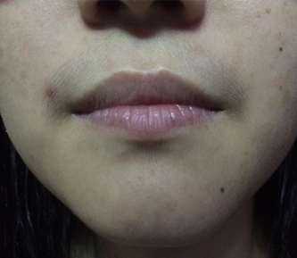 Nhờ mẹo hay này bạn gái chẳng sợ khi wax ria mép da sẽ đỏ ửng, đau tê ...